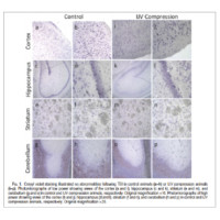 Q-Collar | Priority Designs